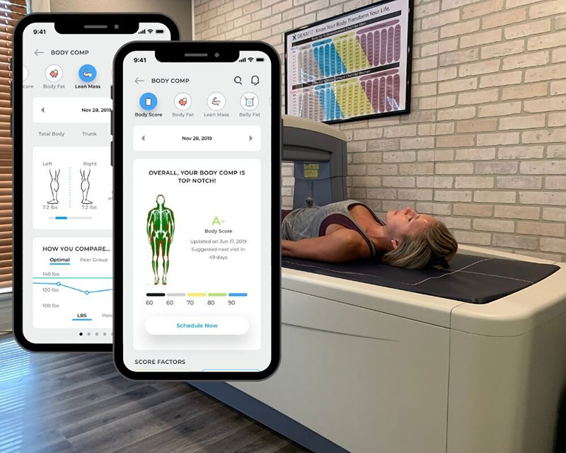 DEXA Scan Philadelphia Body Composition Analysis DEXA Scan Philadelphia Body Composition Analysis